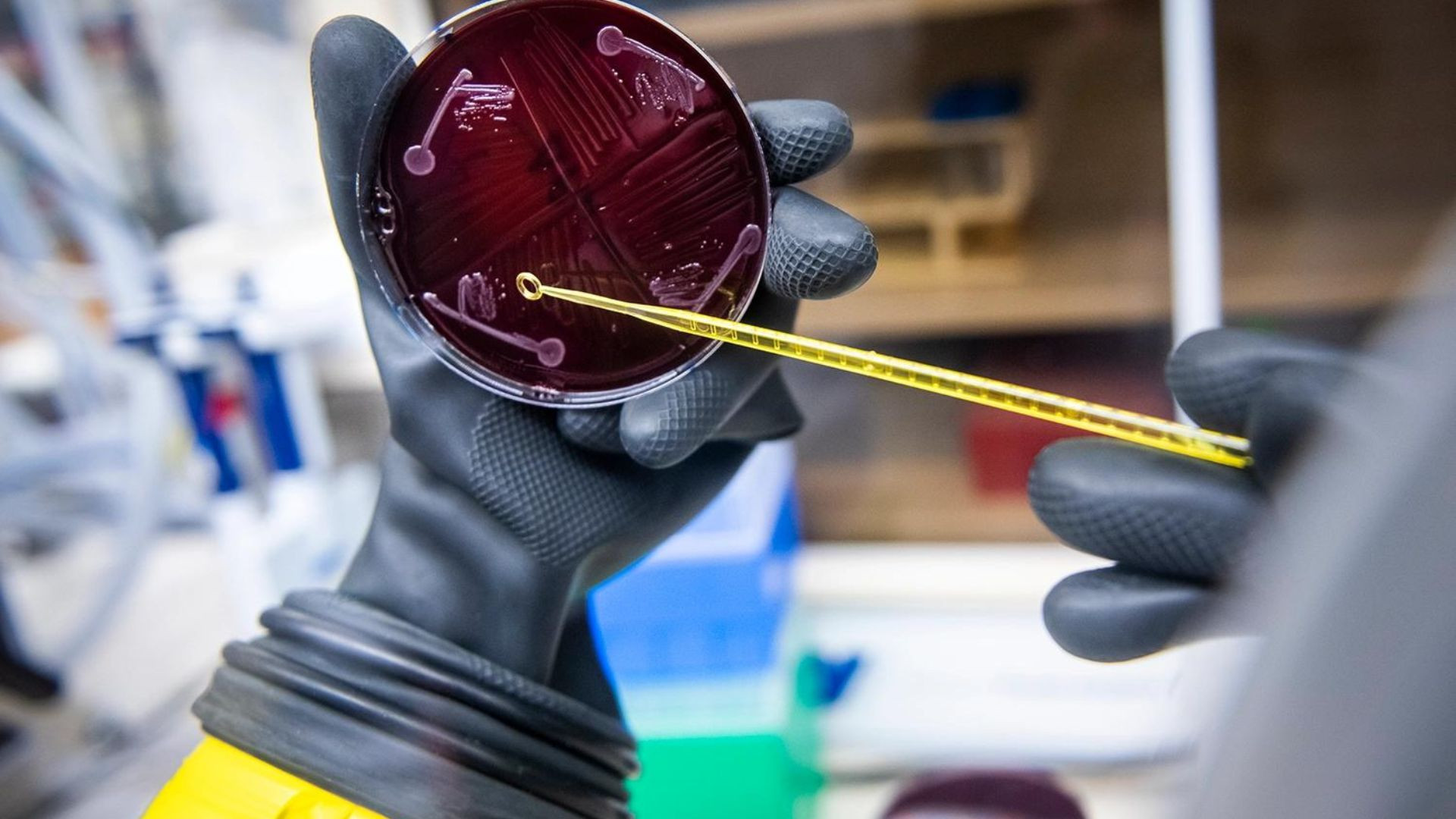 Researchers just built a synthetic human gut microbiome. Now they can ...