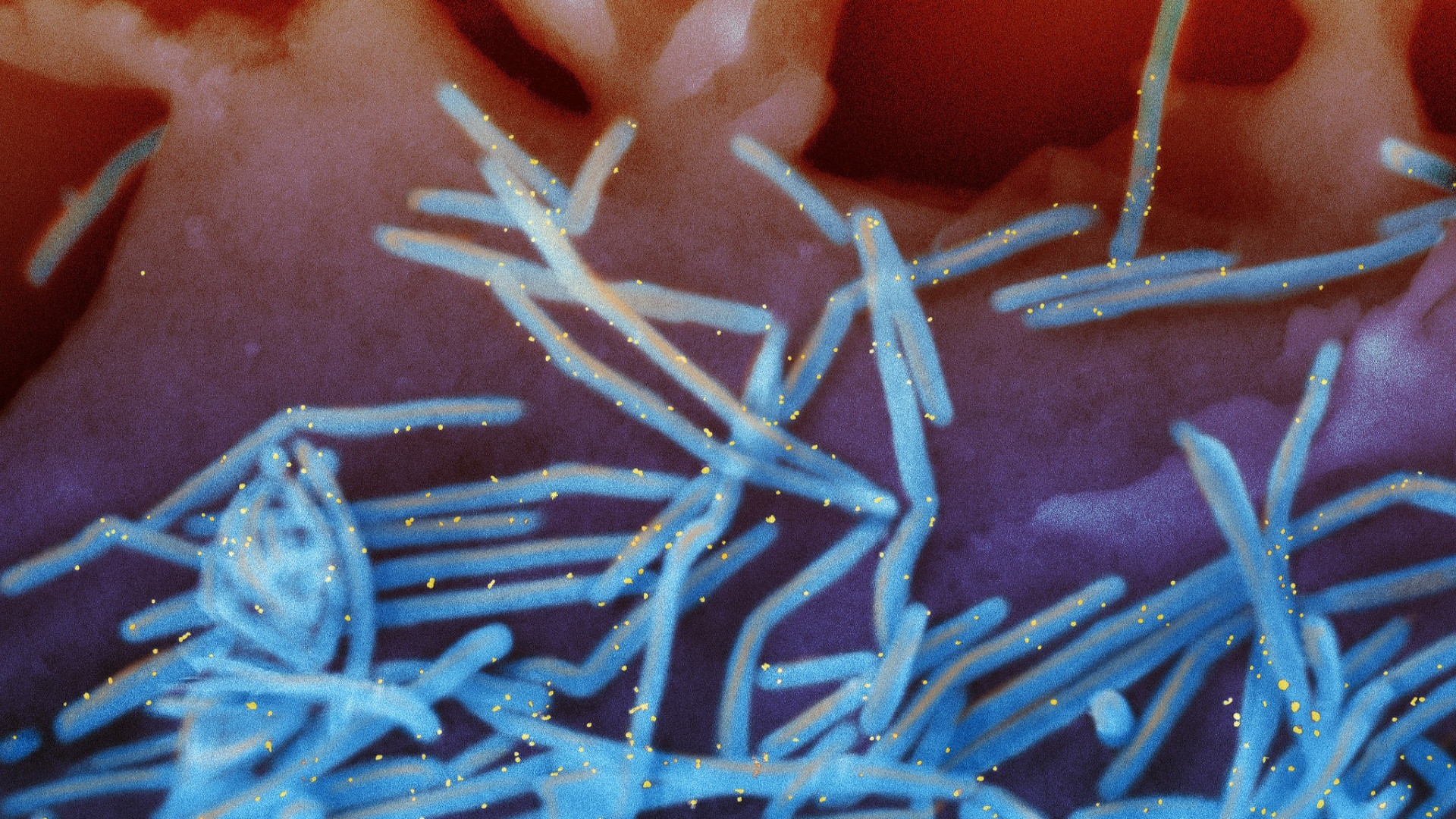 A new study finds a promising approach toward developing broad-spectrum ...