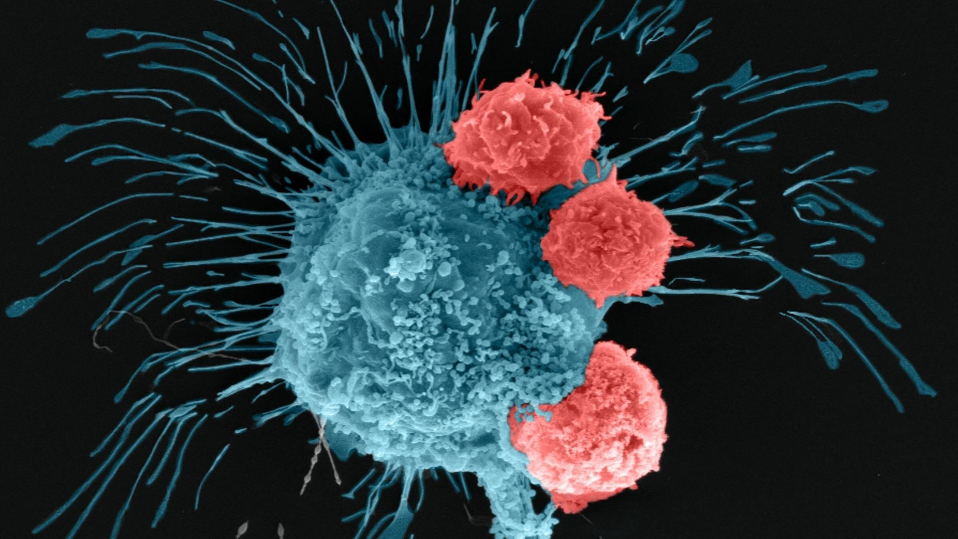 3D bioprinted breast cancer tumors could be a radical new method of ...