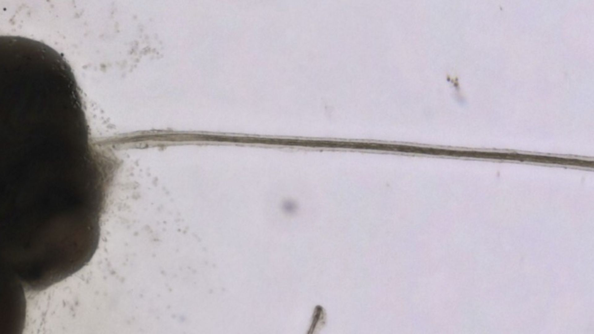 In a first, scientists grow fully mature hair follicles in cultures