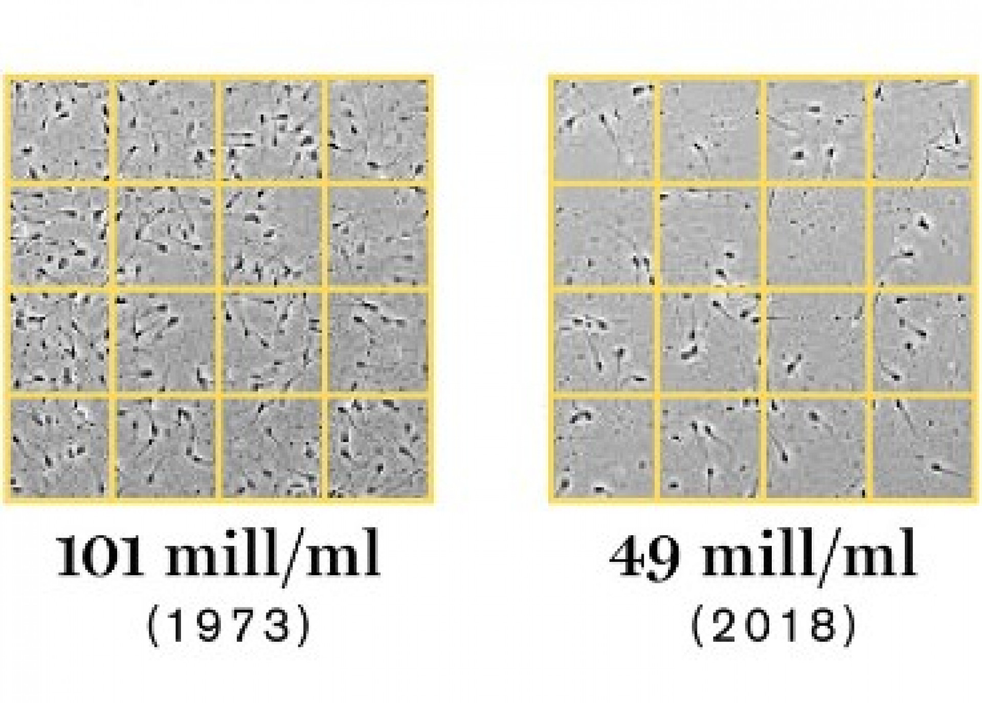 Sperm Concentration Has Declined 51 Percent In The Last 46 Years Finds