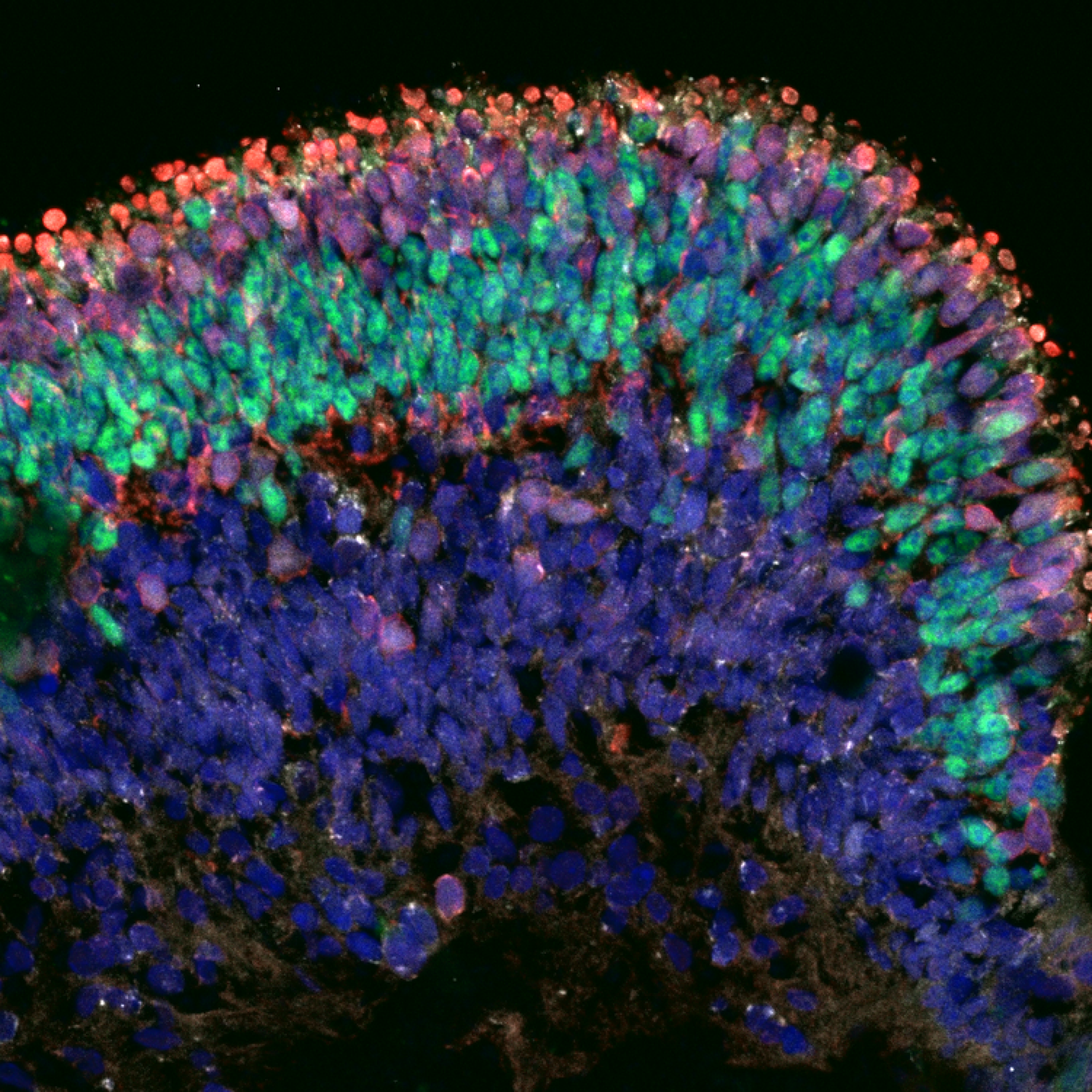 Researchers grow ‘mini eyes’ in a laboratory to assess blindness in a ...