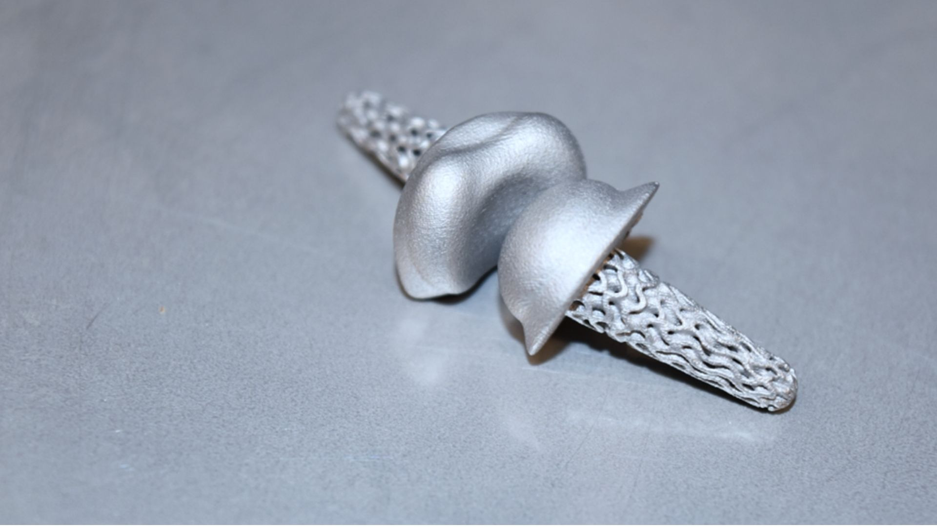Patients will have personalized 3D-printed finger joints developed by AI