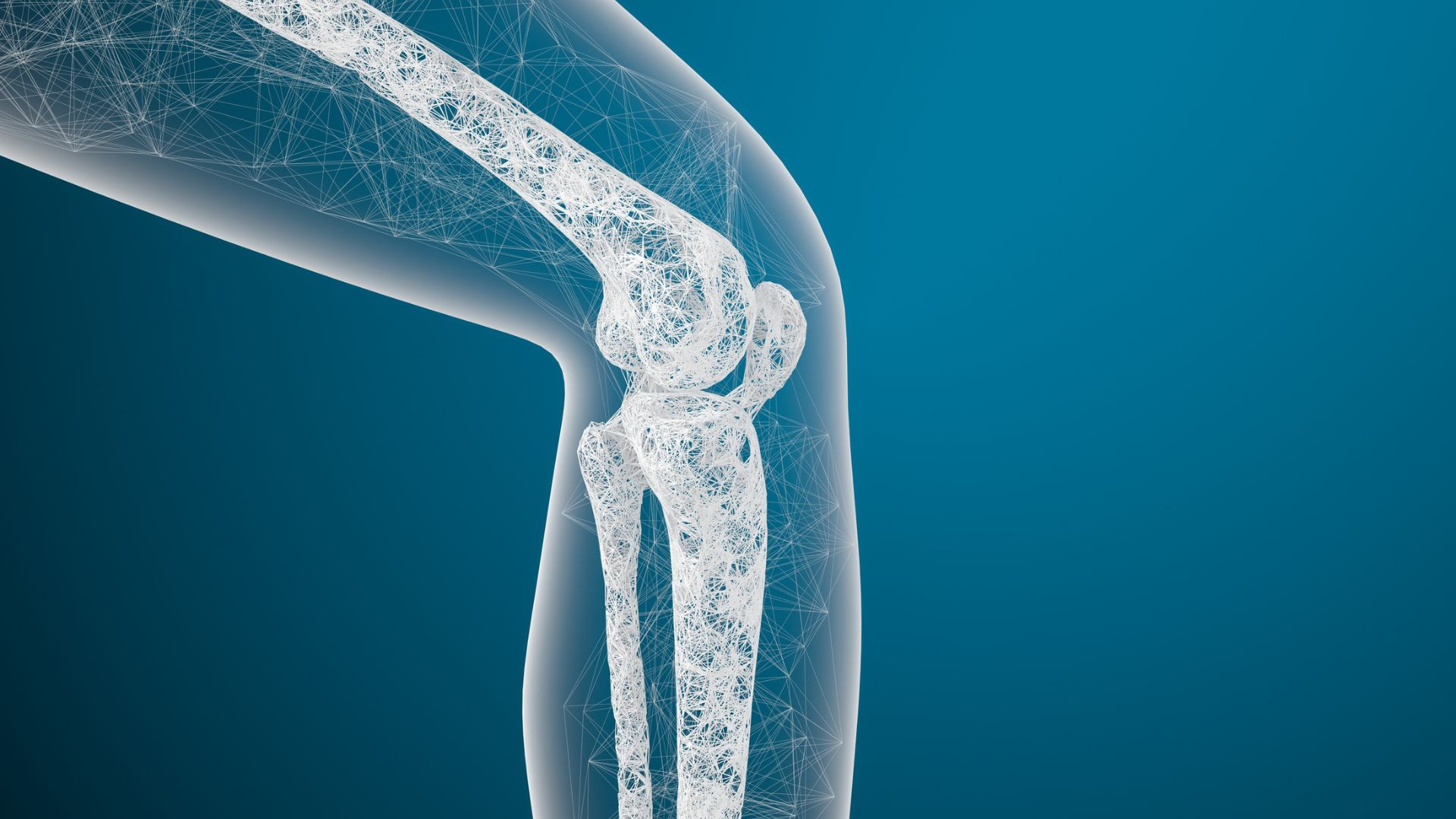 New nano-based technology is a glimmer of hope for osteoporosis treatment