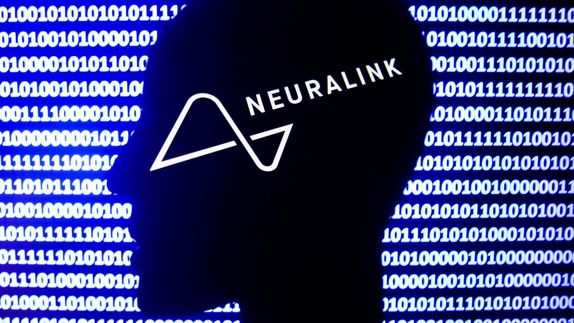 Neuralink wants to tie up with surgical partner who will implant its ...