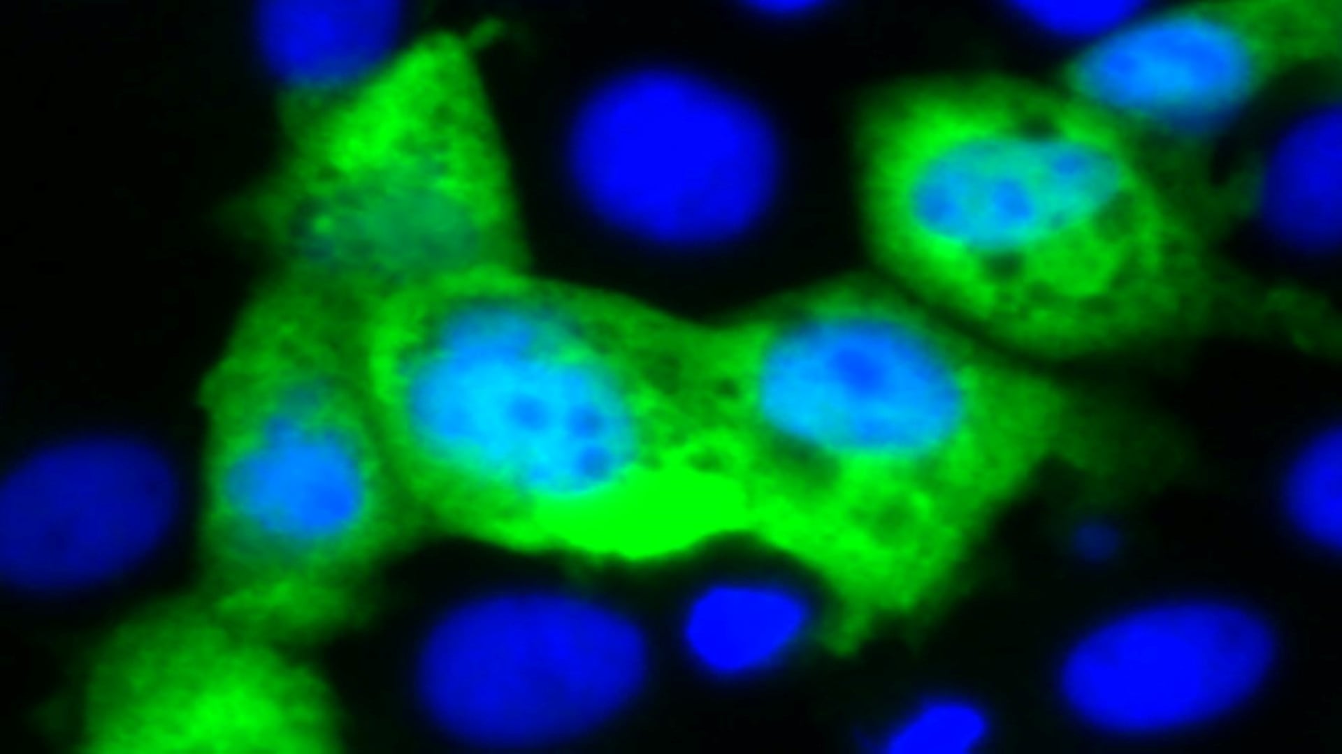 Experimental 'dual vaccine' takes aim at norovirus, the top foodborne ...