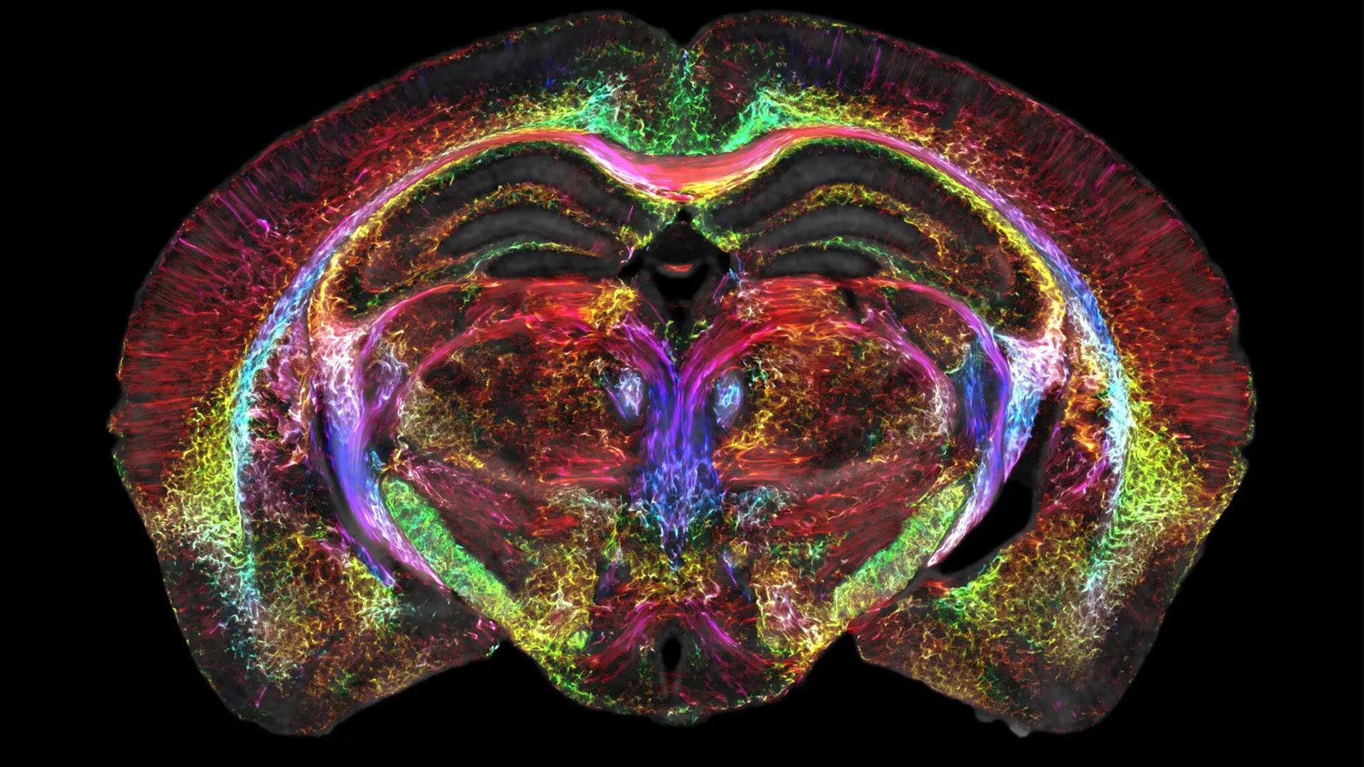 Forty years in the making: Advanced MRI scan reveals brain images 64 ...