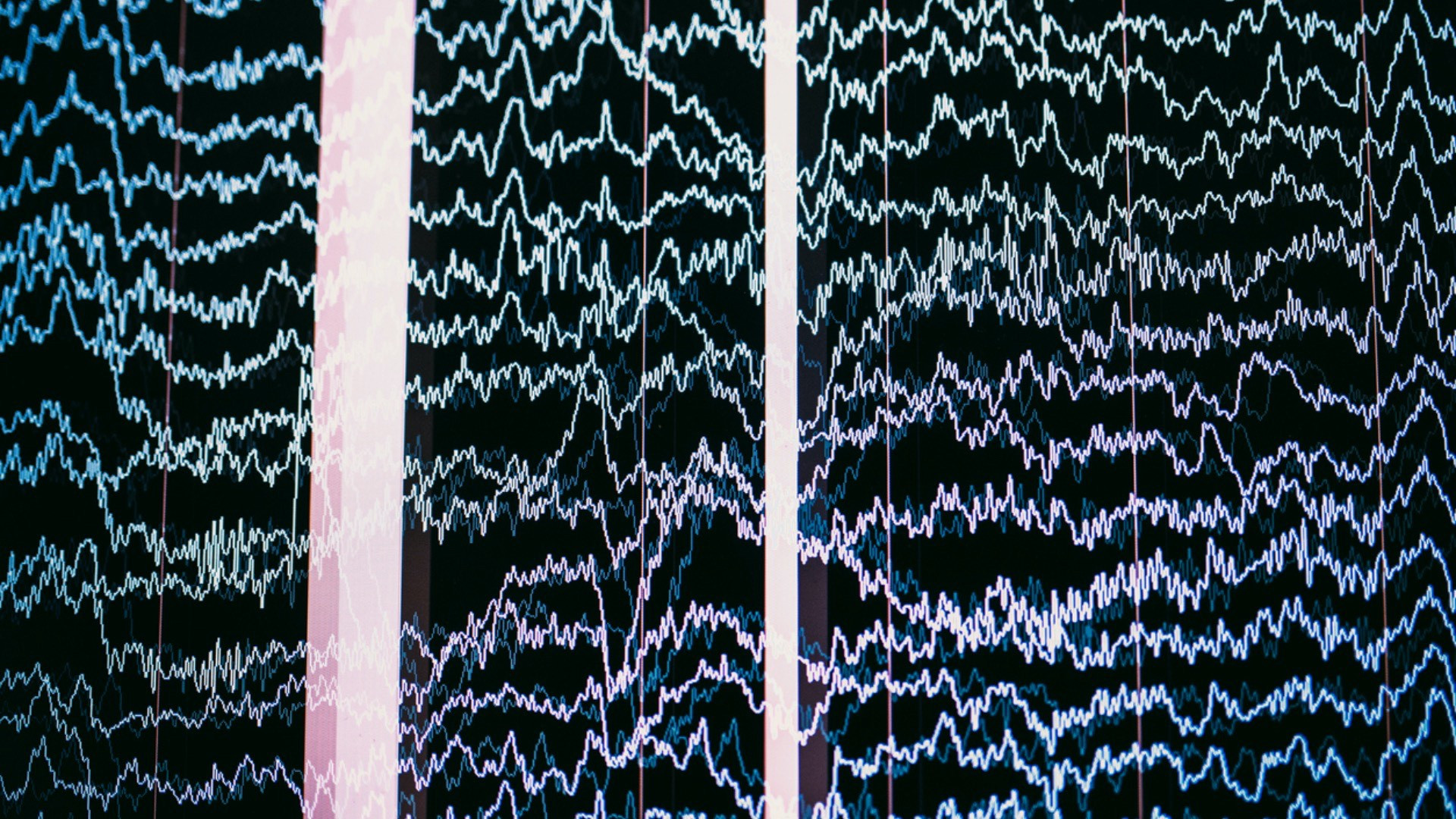 What triggers the brain surge in the final moments of life? Scientists ...