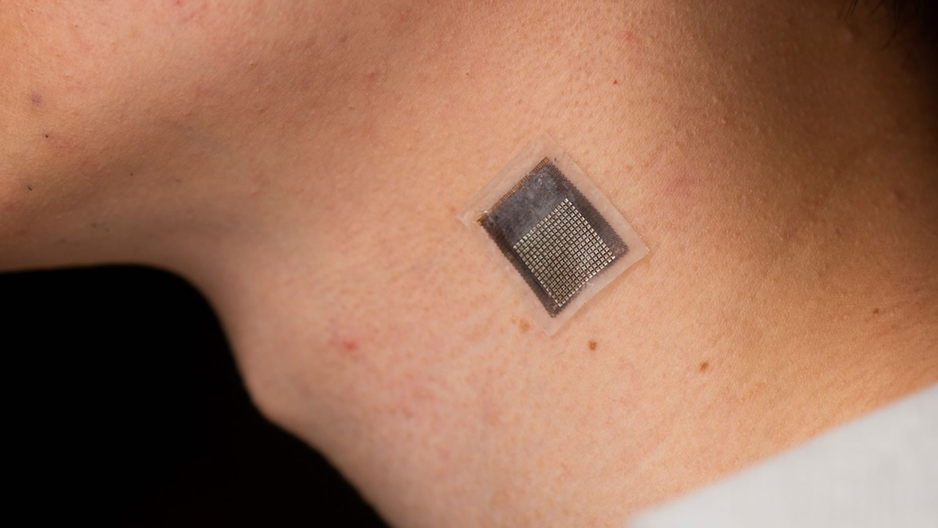 This new wearable could help treat cancer or sports injuries
