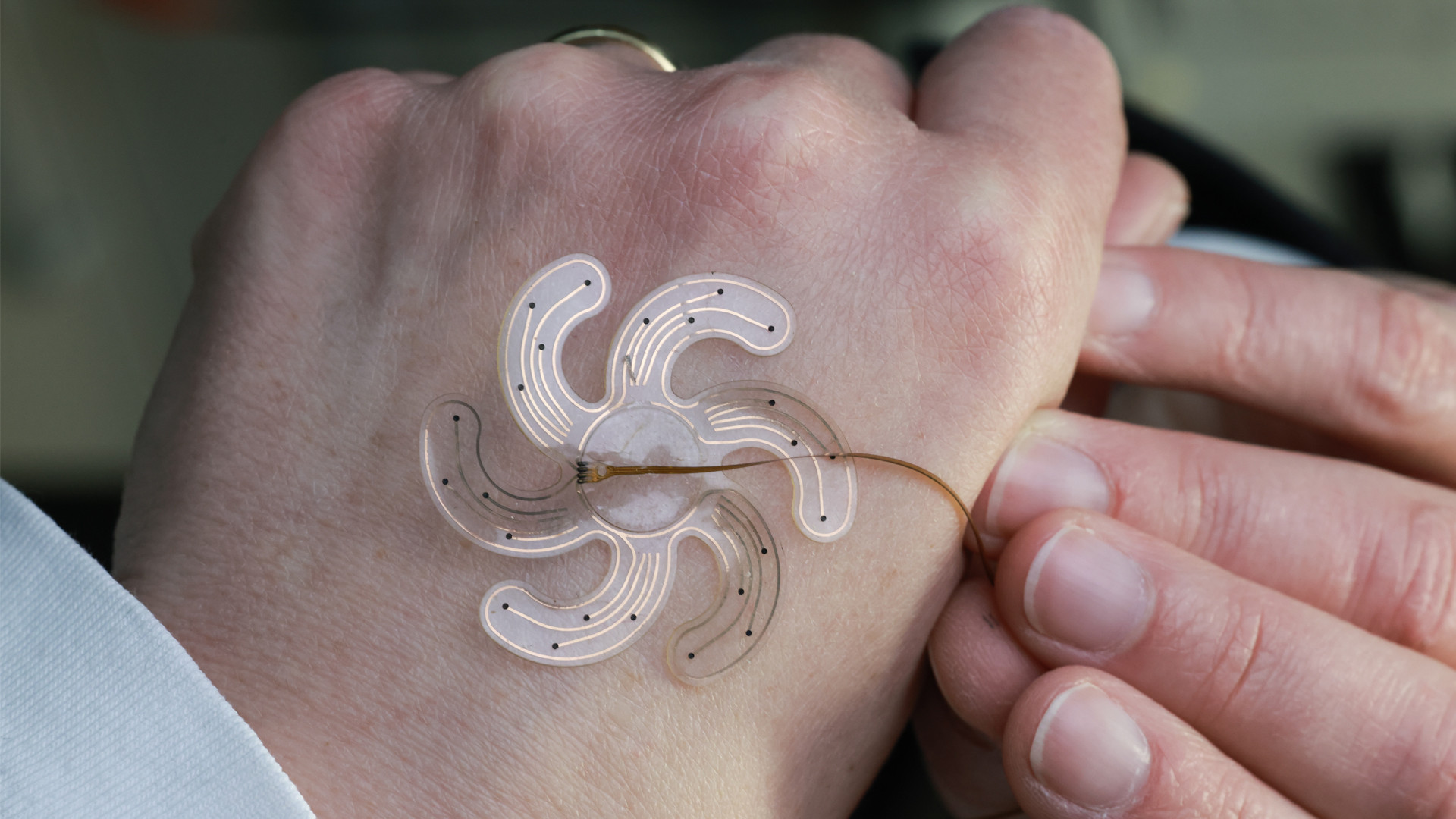 This flower-shaped electrode promises minimally invasive brain surgeries