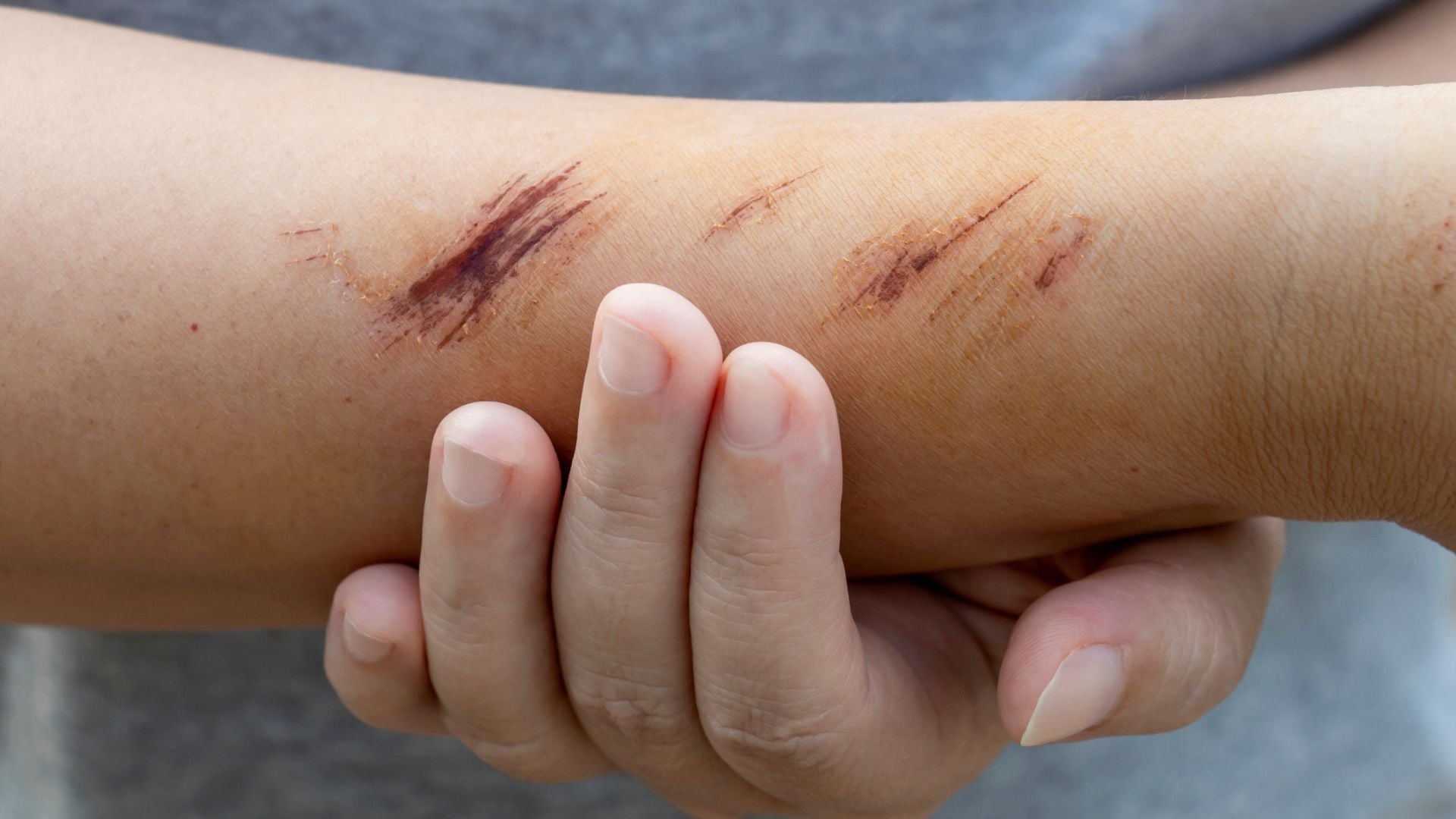 New study shows how PAINTing with wound-healing ink can promote quick ...