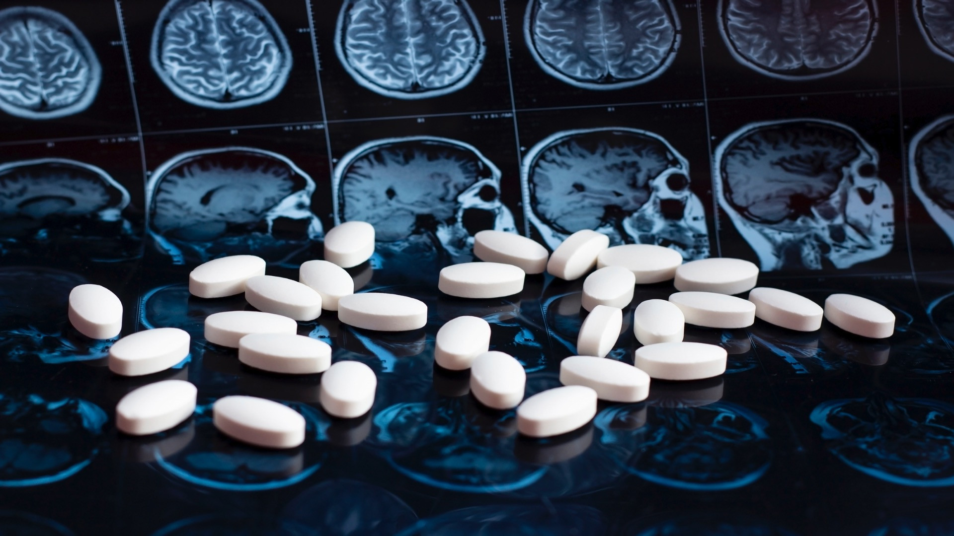 FDA paves way for full approval of new Alzheimer's drug