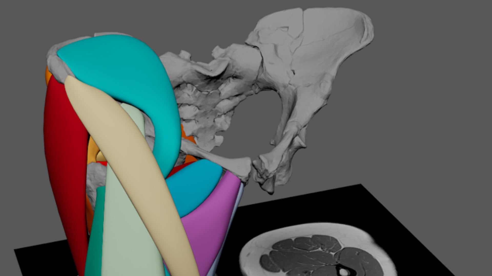 3D muscle reconstruction reveals 3.2 million-year-old ancestor walked ...