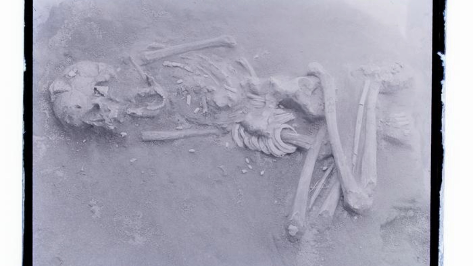 The ancient Japanese used to deform skulls, intentionally