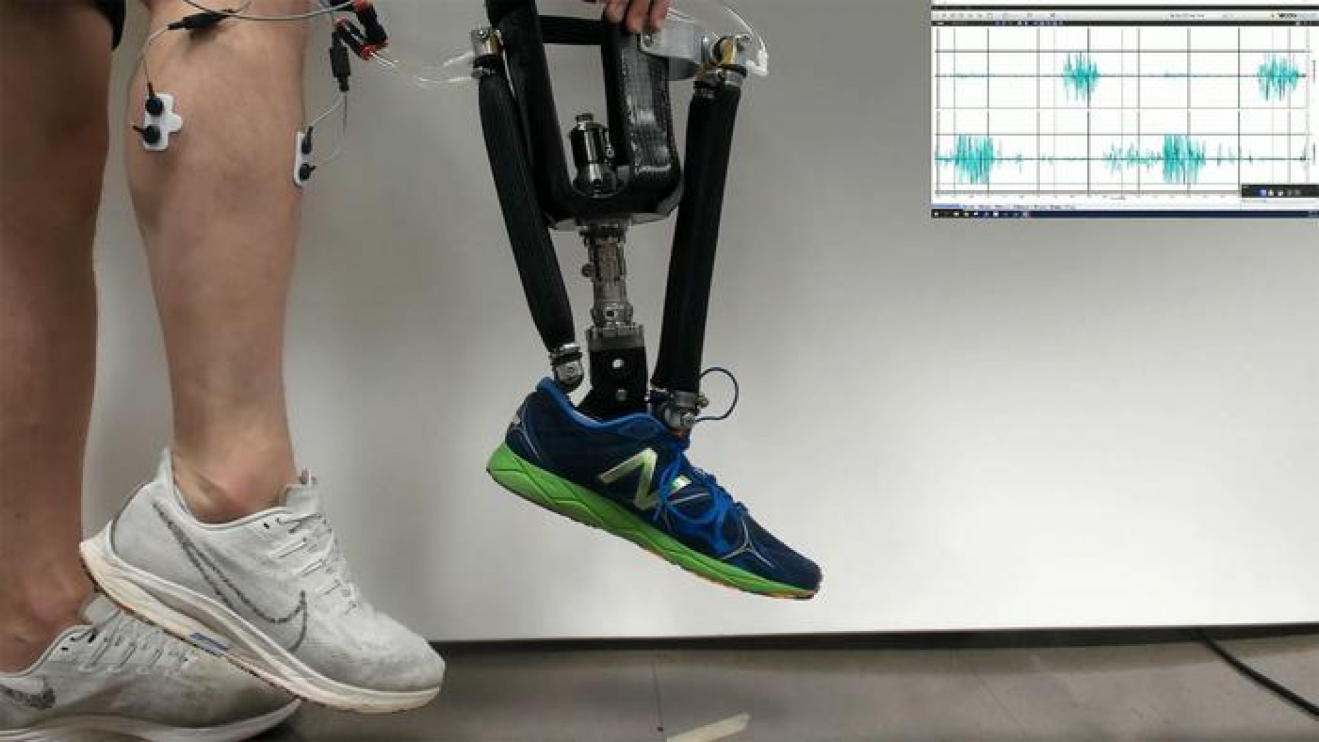 Robotic prosthetic ankle improves ‘natural’ limb movement
