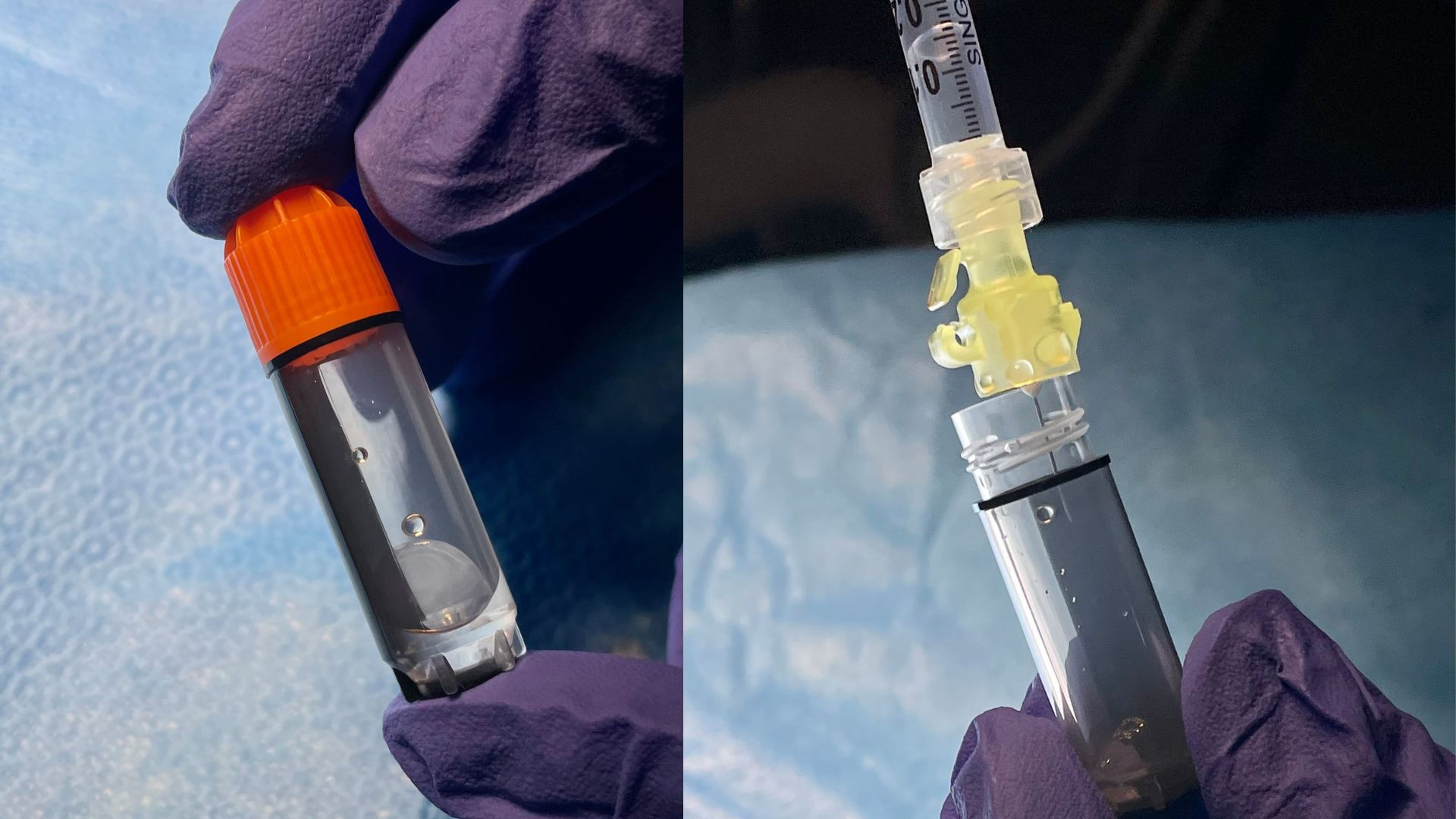 Cutting-edge AI predicts molecular age and illnesses from eye fluid