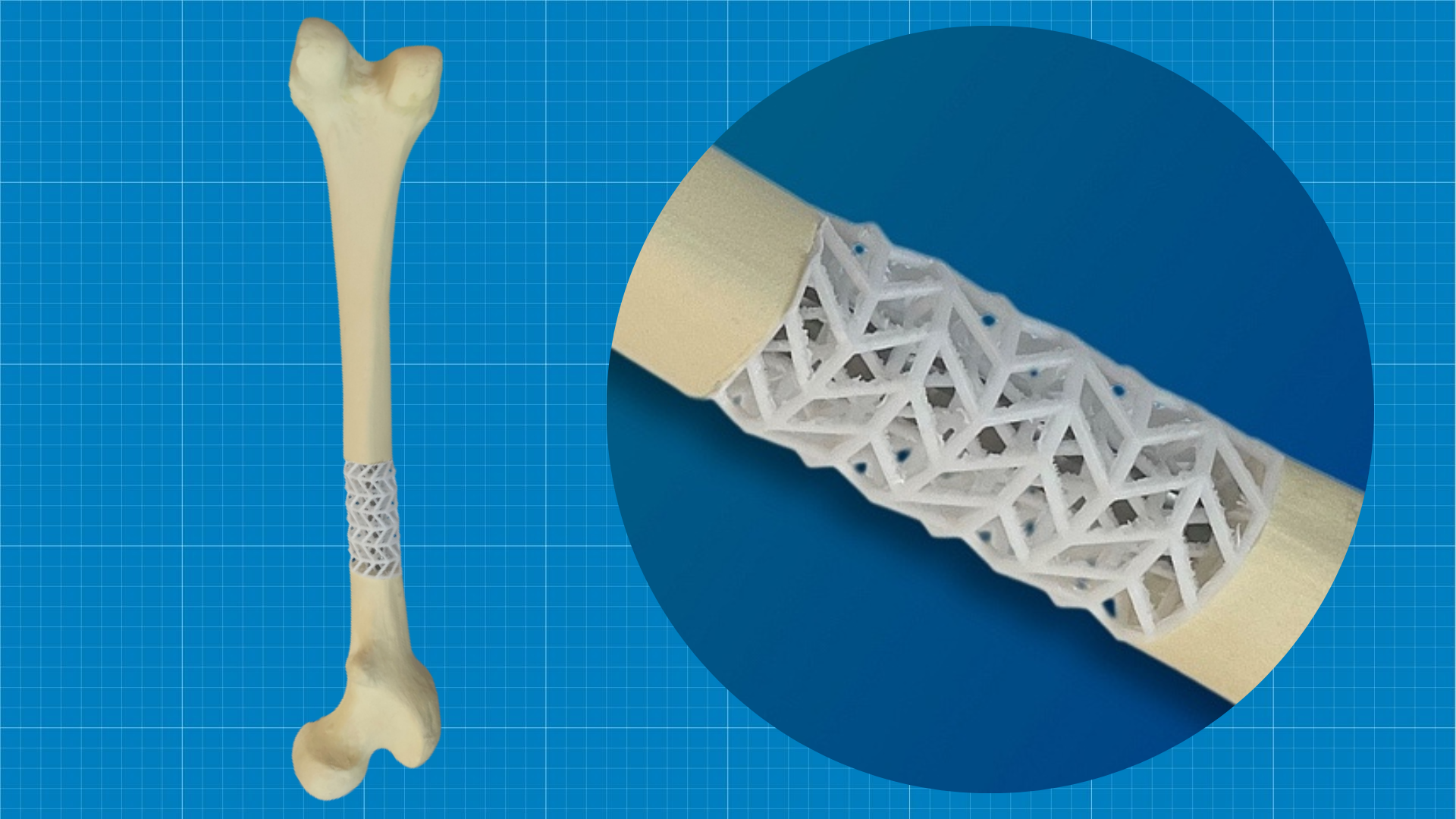 Scientists develop healing scaffold that biodegrades into broken bones