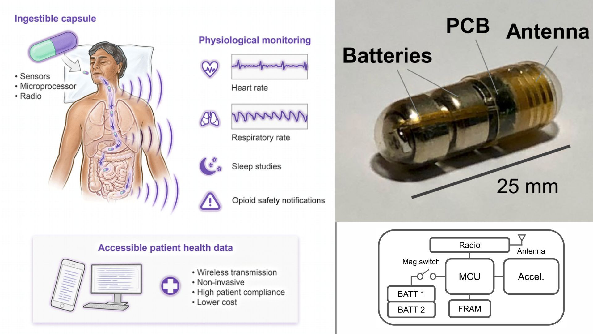Swallowable device tracking vital signs inside the body in human trial