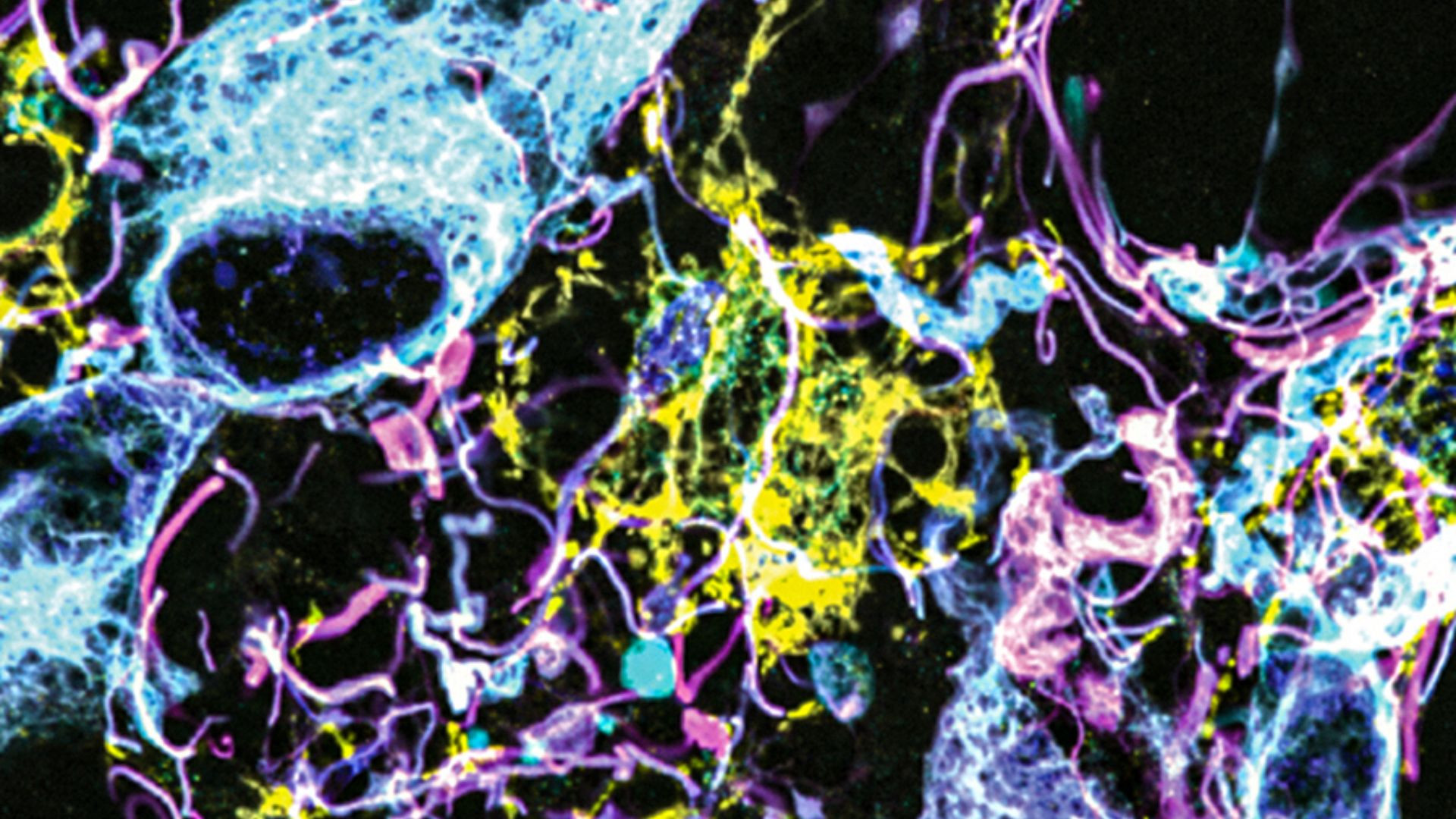 New imaging technique reveals new insights in human brain tissue