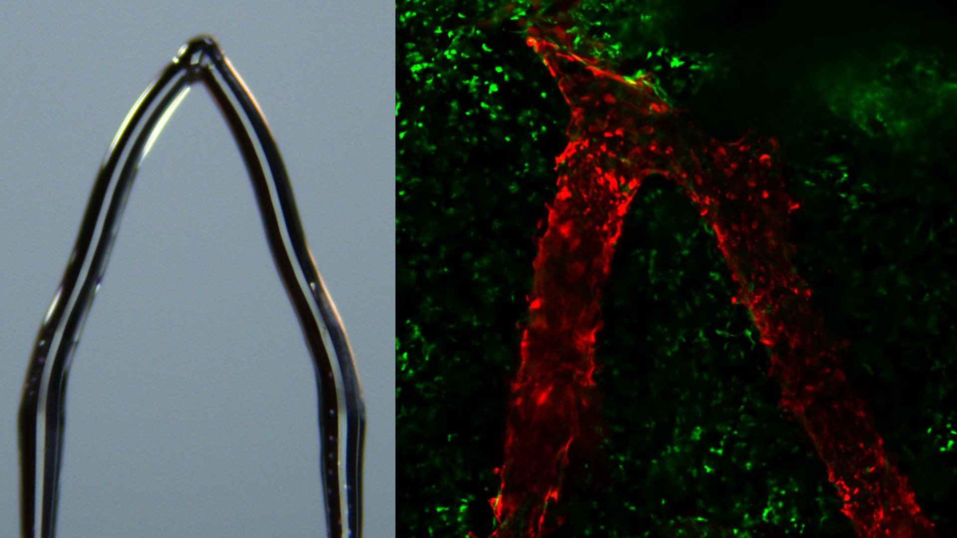 Ice 3D printing can eliminate queues for organ transplants