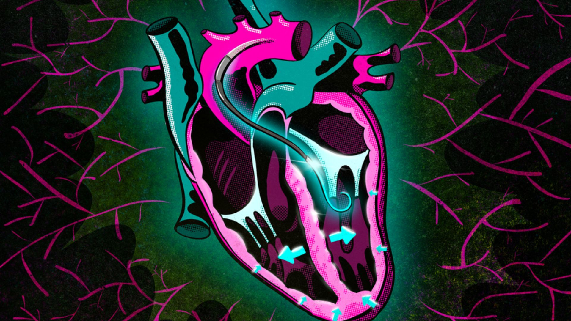 MIT's breakthrough discovery for cardiogenic shock patients