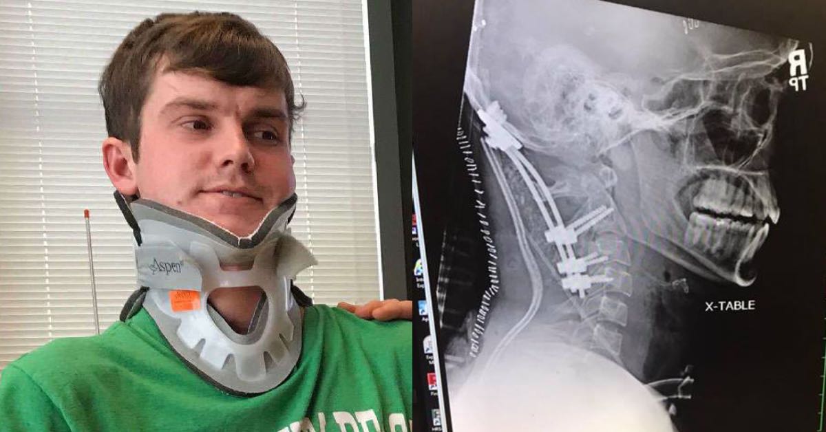 Brain Cancer Survivor Miraculously Recovers From ‘Universally Fatal ...