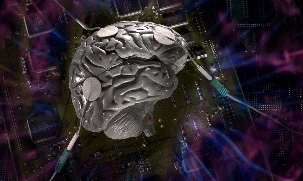 Experimental Brain Implant Boosts Memory by 15 Percent