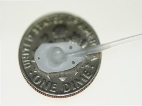 New Tiny Heart Device Could Stop Heart Disease in Its Tracks