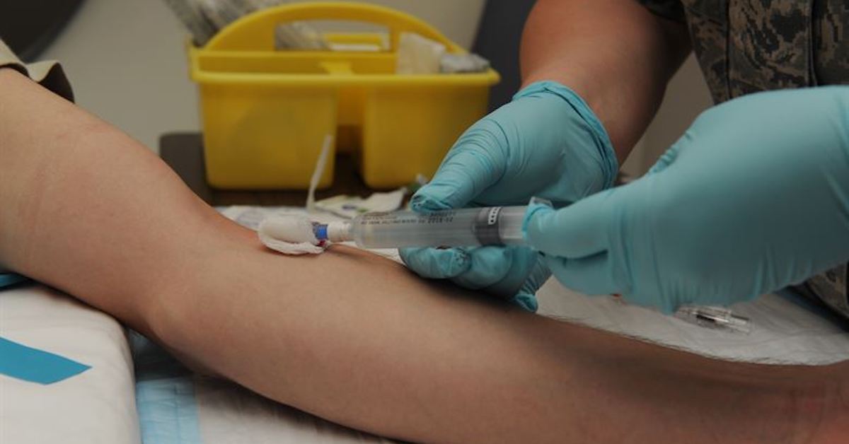 Bioengineered Blood Vessels Improve Long-Term Dialysis Experience