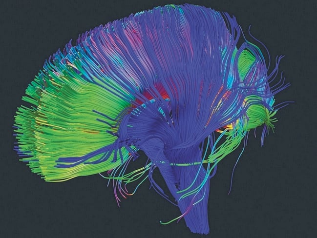 Scientists Are Using Holograms to Edit Brain Activity