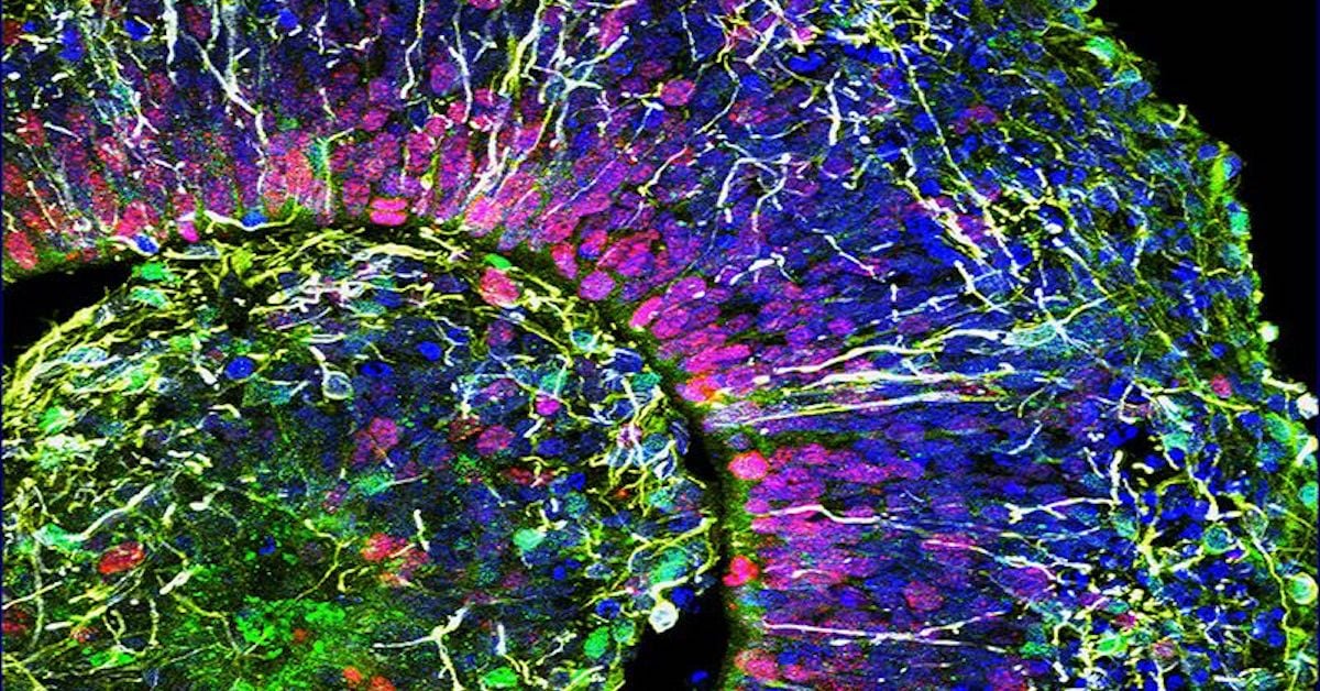 Tiny Brains Grown in Labs Produce Electrical Signals Like Premature Babies
