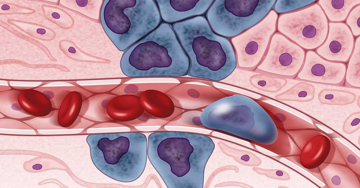 New Way to Kill Treatment-Resistant Cancer Stem Cells Discovered