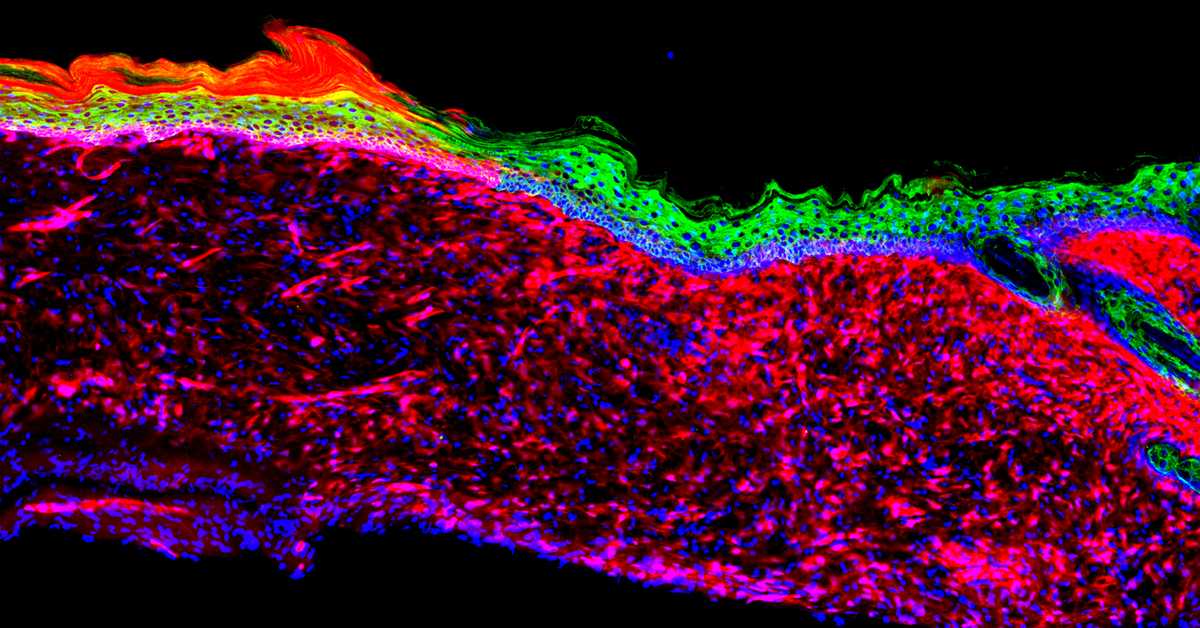 Researchers Program Open Wounds to Transform Into Skin