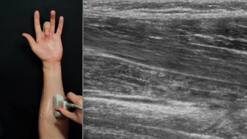 Smartwatches of the Future Could Use Ultrasound Technology to Sense ...