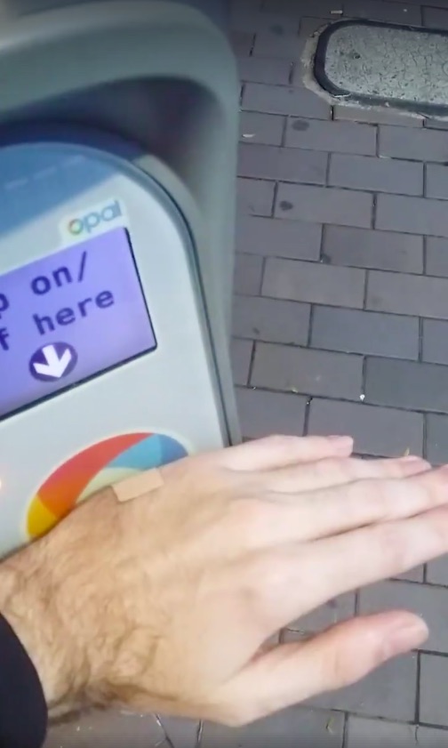 Biohacker Implants Travel Card in His Hand For A Hassle-Free Commute