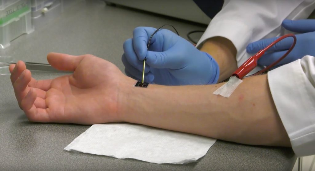 This Tiny Microchip Can Heal Live Tissue with a Single Touch