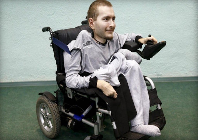 Russian Programmer Volunteers For First Human Head Transplant, Next Year