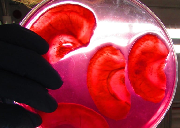 This Scientist Creates Ears Out of Apples
