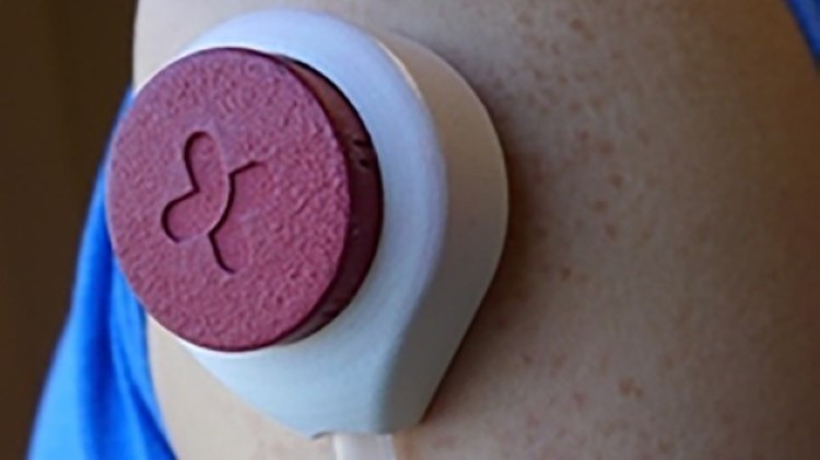 HemoLink Sampling Device Could Put an End to Needles for Blood Testing