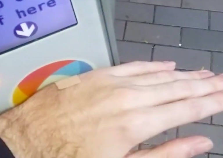 Biohacker Implants Travel Card in His Hand For A Hassle-Free Commute