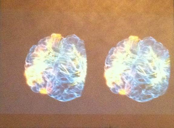 Neuroscientists use headset to explore the brain in real time