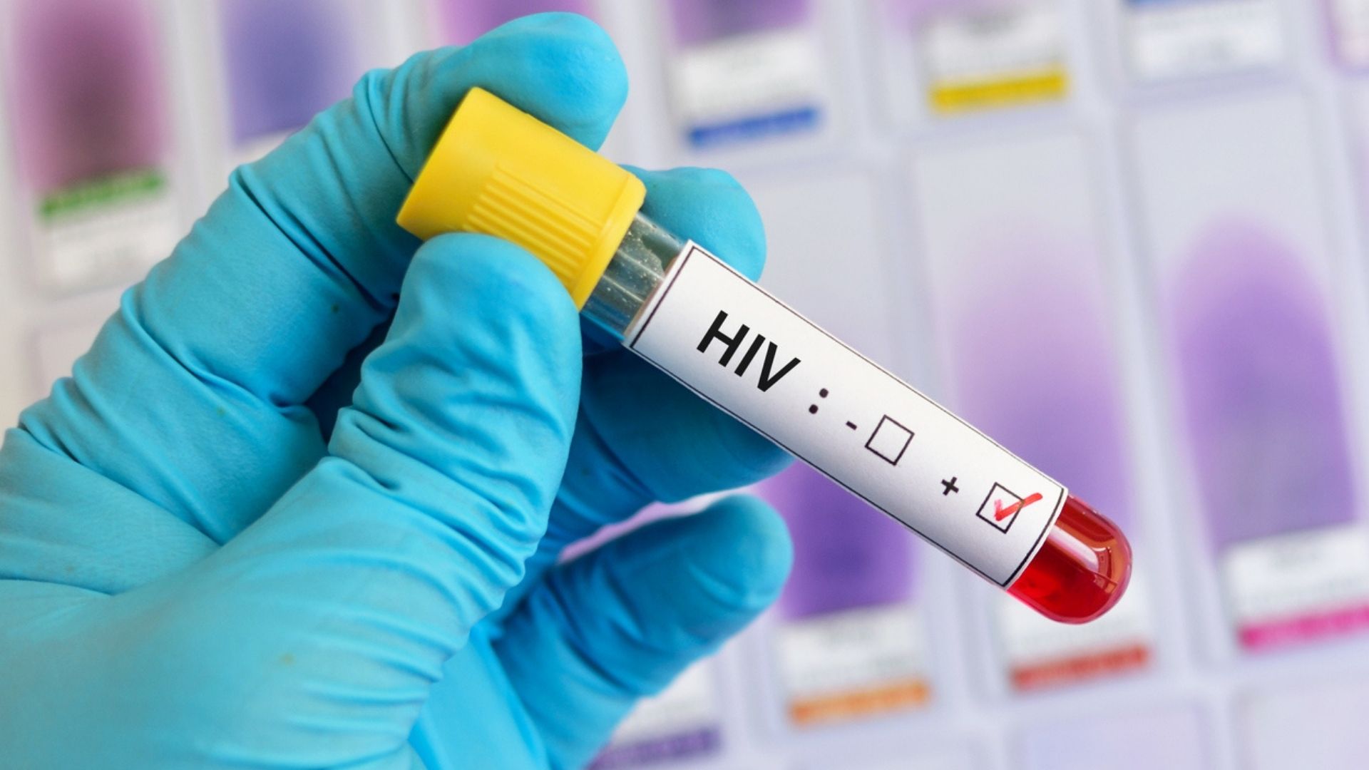 A Breakthrough Treatment That Could Eradicate HIV to Begin Human Trials
