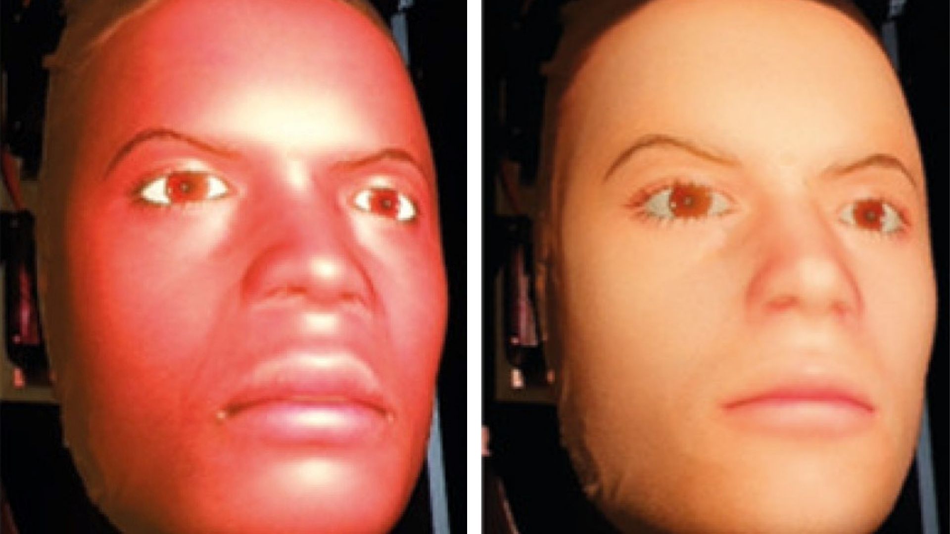 Scientists engineer robots with realistic pain expressions to train doctors