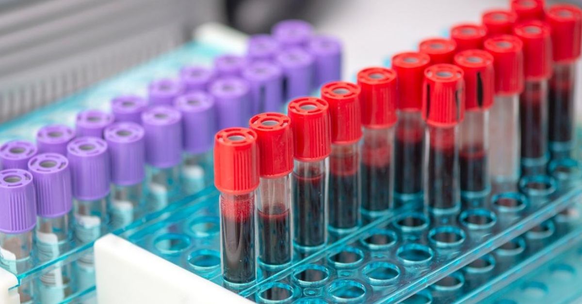 New Blood Test Detects Cancer 4 Years Ahead of Symptoms