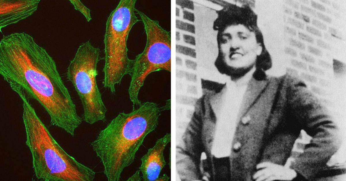 The Immortal Woman: Henrietta Lacks and HeLa Cells