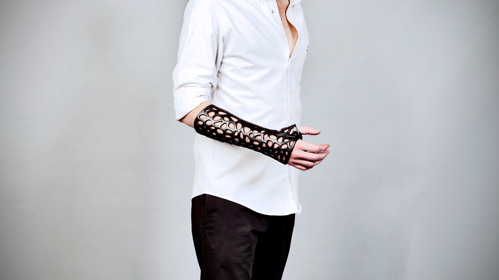 3D Printed Cast Heals Bones 40% Faster, Enables Ultrasound Treatment