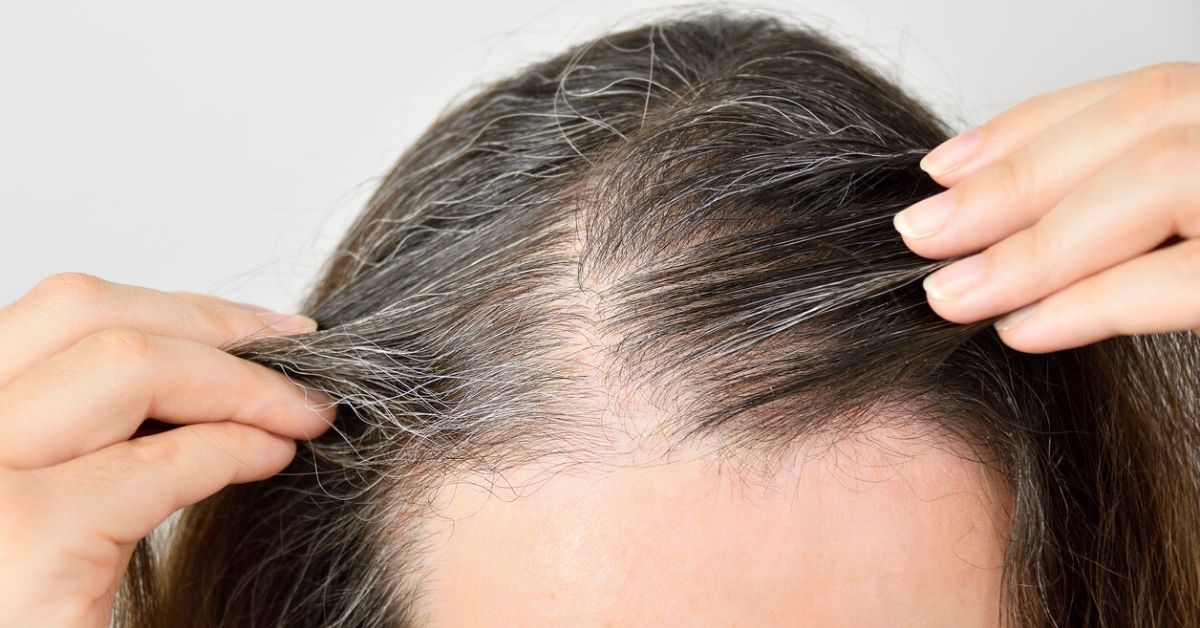 Turns out Stress Really Does Turn Hair Gray, Scientists Confirm