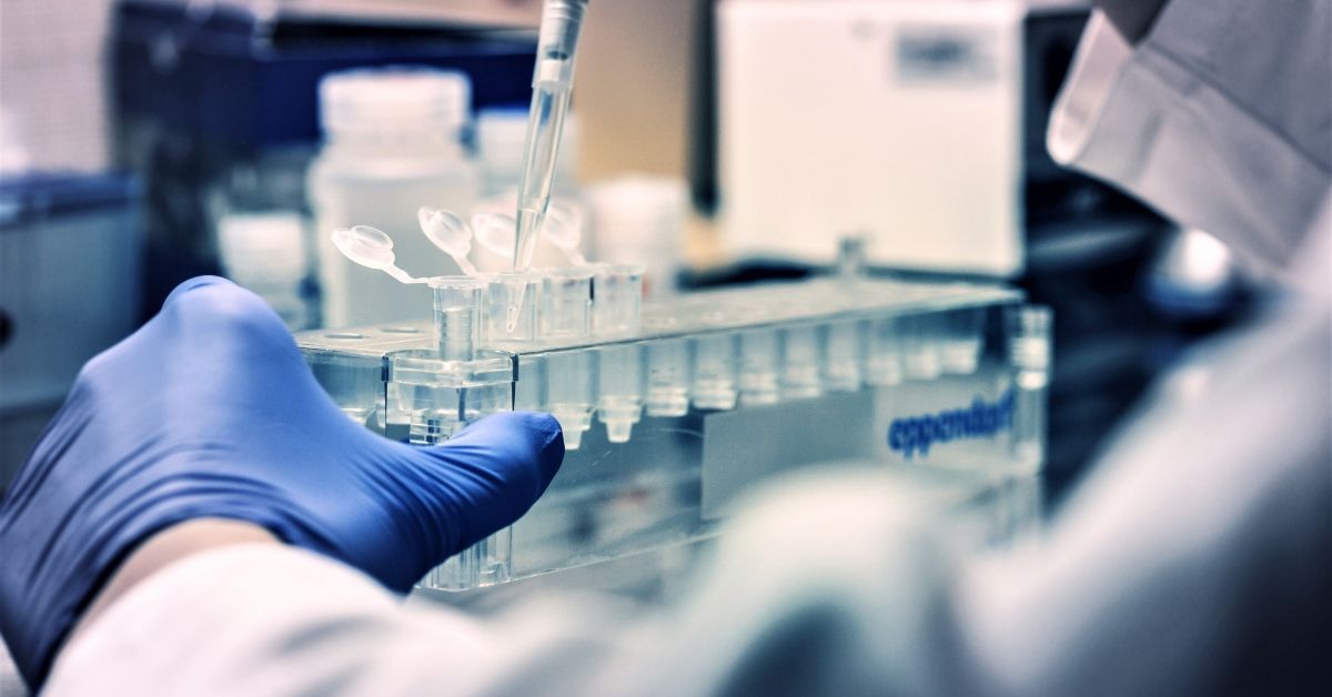 FDA Has Authorized Two-Minute Antibody Test Kit to Identify Coronavirus ...