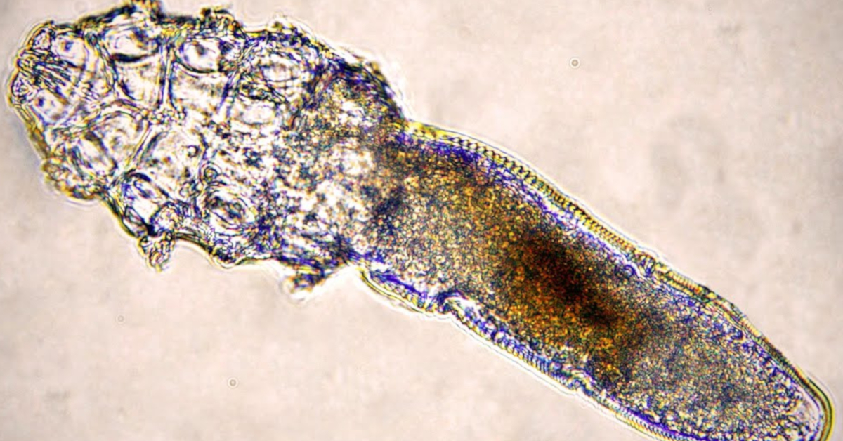 These 'Face Mites' Live in Your Pores and Mate on Your Face