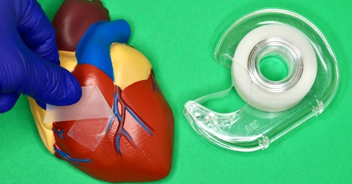 Super-Strong Surgical Tape Can Be Used on Internal Organs and Is ...